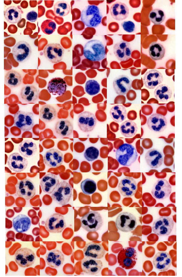 Solved Lab Act 2: WBC differential counts - Lab report A. | Chegg.com