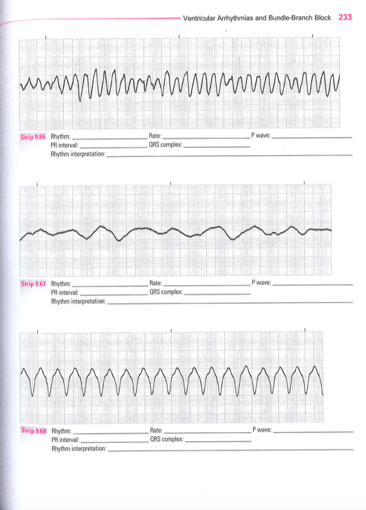 Solved Ventricular Arrhythmias and Bundle-Branch Block 233 | Chegg.com