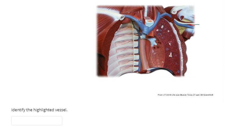 Solved Identify the highlighted vessel Identify the | Chegg.com