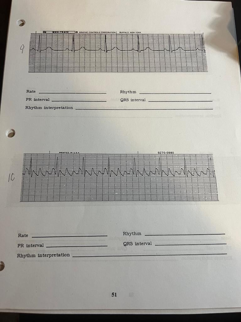 Solved Rate Rhythm PR interval QRS interval Rhythm | Chegg.com