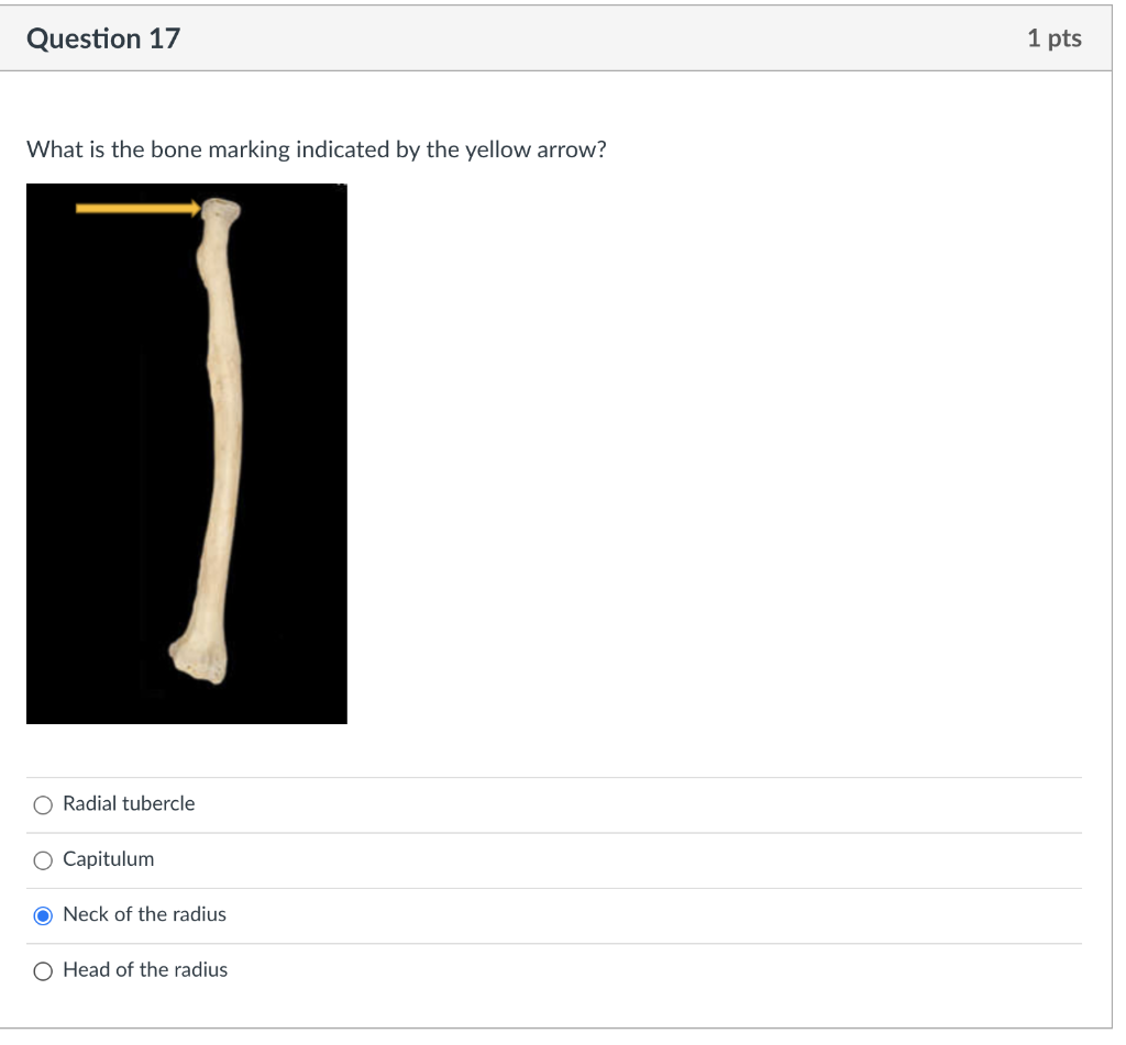 Solved Question 1 1 pts What vein is being indicated by the | Chegg.com