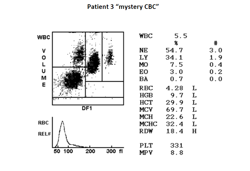 Solved Patient 3 “mystery CBC" WBC WBC 5.5 54.7 34.1 7.5 3.0 | Chegg.com