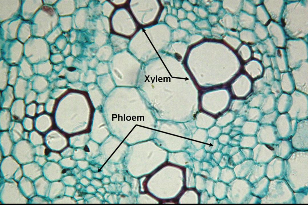 Phloem Secondary Xylem Primary Xylem Xylem Phloem | Chegg.com