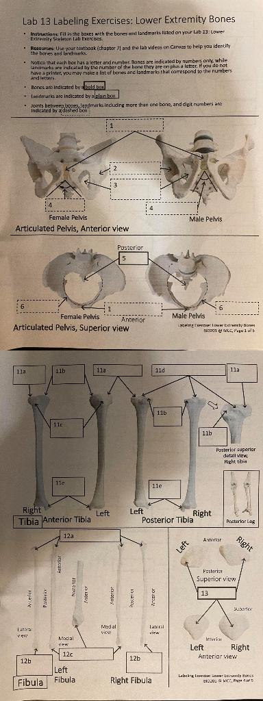 Solved Lab 13 Labeling Exercises: Lower Extremity Bones | Chegg.com