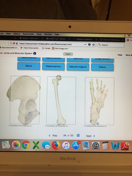 Solved place the following muscles into the appropriate | Chegg.com Solved place the following muscles into the appropriate | Chegg.com