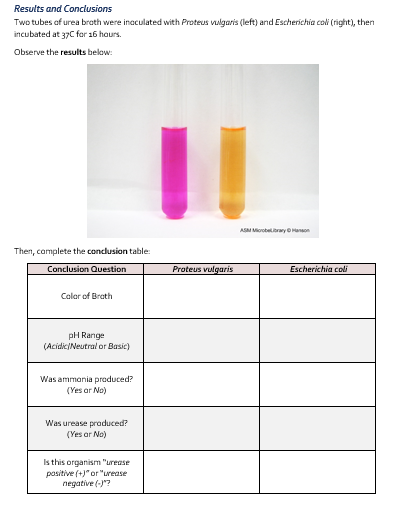 Solved Results and Conclusions Two tubes af urea broth were | Chegg.com