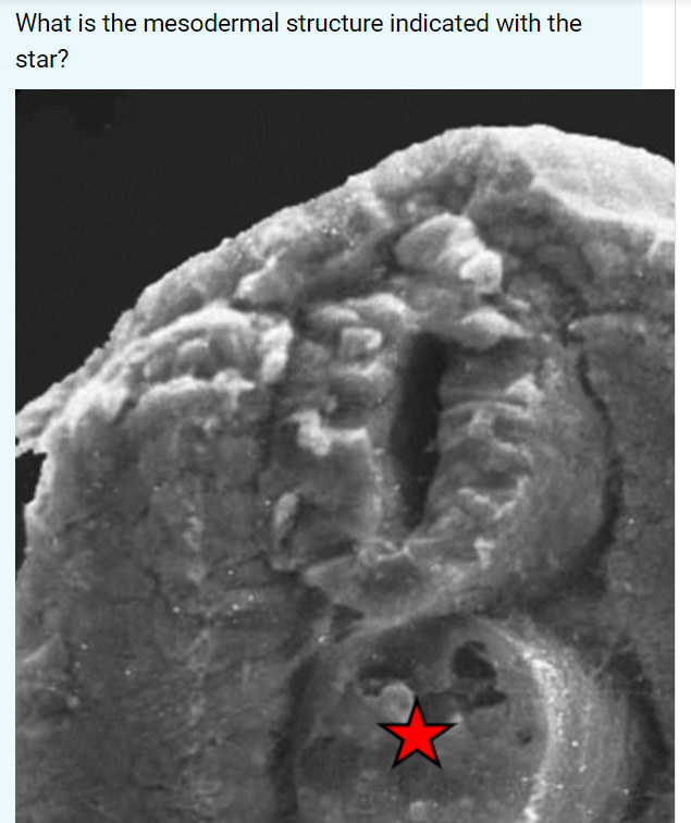 Solved What is the mesodermal structure indicated with the | Chegg.com