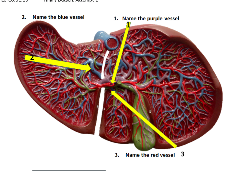 Solved 2. Name the blue vessel 1. Name the purple vessel 3. | Chegg.com
