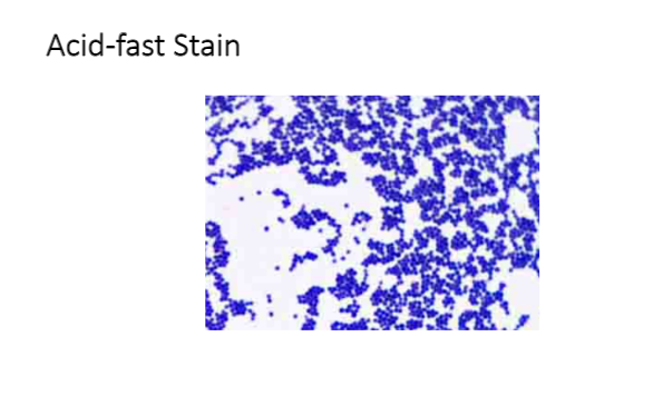 E Coli Acid Fast Stain Acid Fast Staining Principle, Procedure