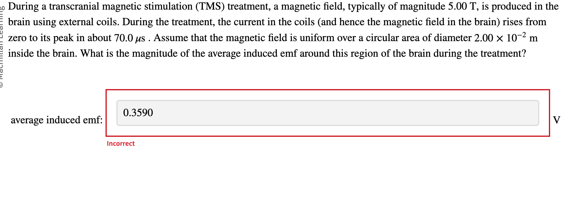Solved During a transcranial magnetic stimulation (TMS) | Chegg.com