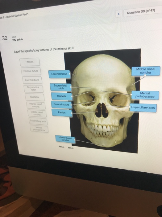 Solved Question 30 (of 47) b 6-Skeletal System Part 30 232 | Chegg.com