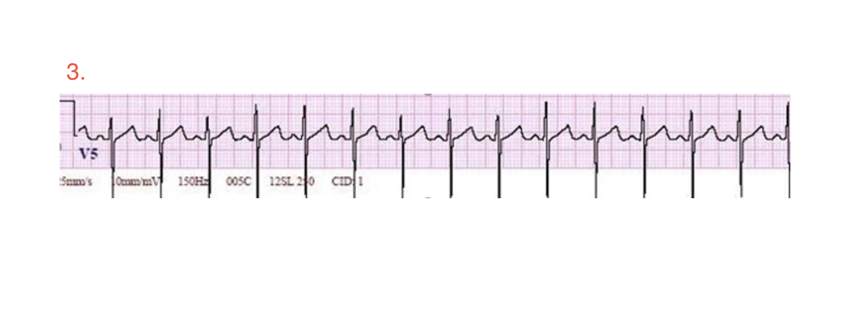 Solved Please find Heart Rate and Rhythm (regular/irregular) | Chegg.com