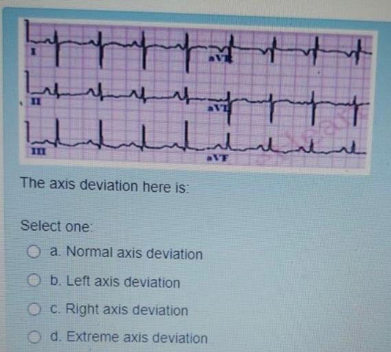 Solved 144 لہسلسلہ اساس# لیلی لے لم لم The axis deviation | Chegg.com