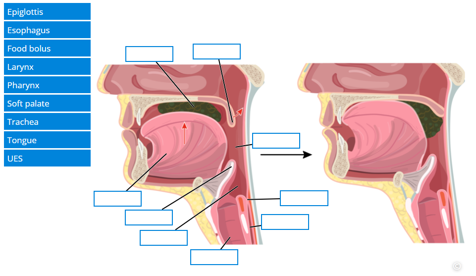 Solved Label this image that shows the upper GI tract at the | Chegg.com