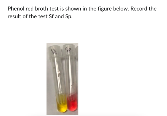 Solved Identify the biochemical test to differentiate Gram's | Chegg.com