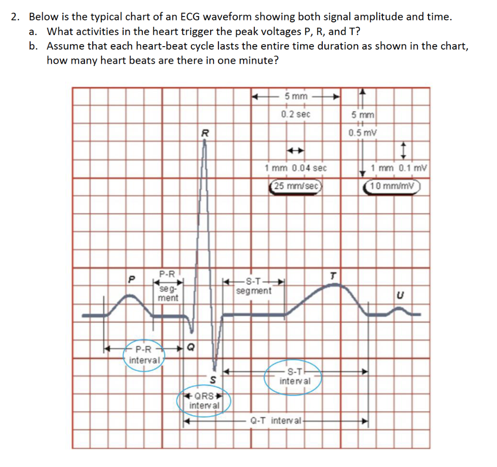 Solved 2. Below is the typical chart of an ECG waveform | Chegg.com