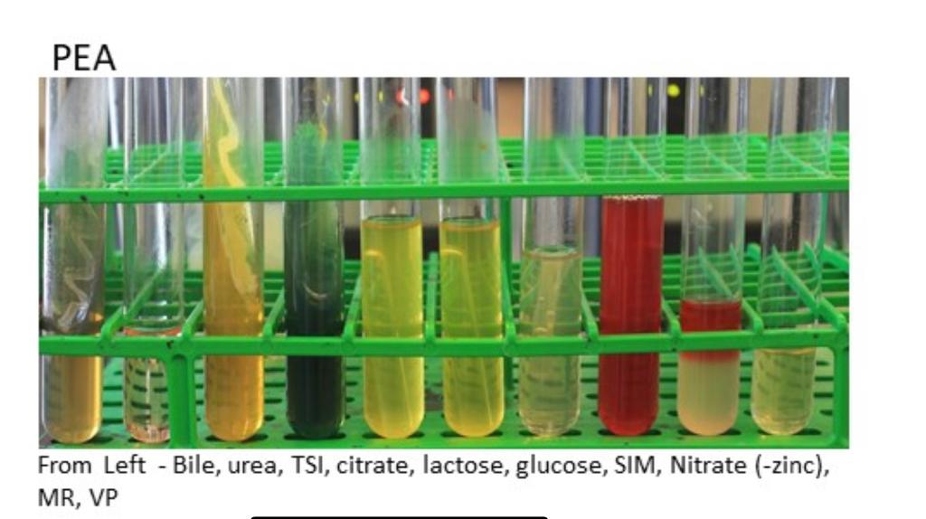 Solved PEA TI From Left - Bile, urea, TSI, citrate, lactose, | Chegg.com