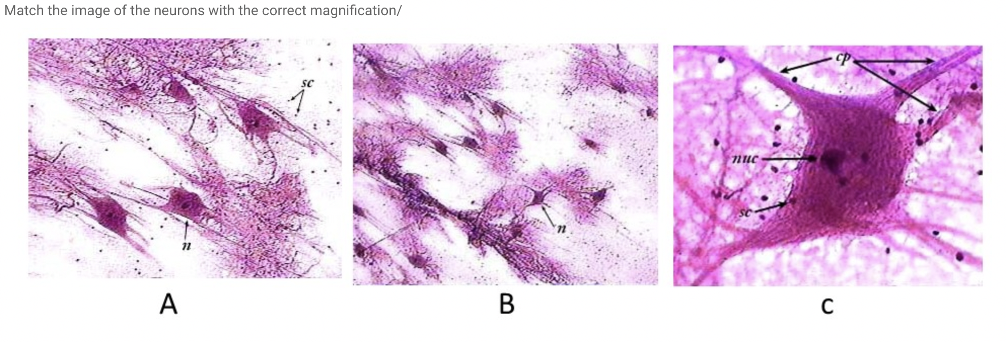Solved Match the image of the neurons with the correct | Chegg.com