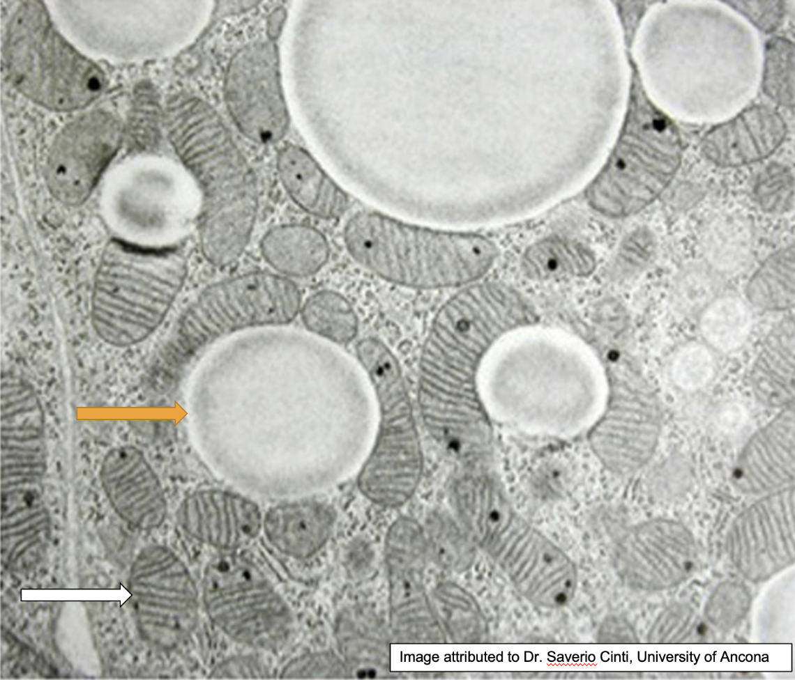 This is a micrograph of the cytosol of an adipocyte | Chegg.com