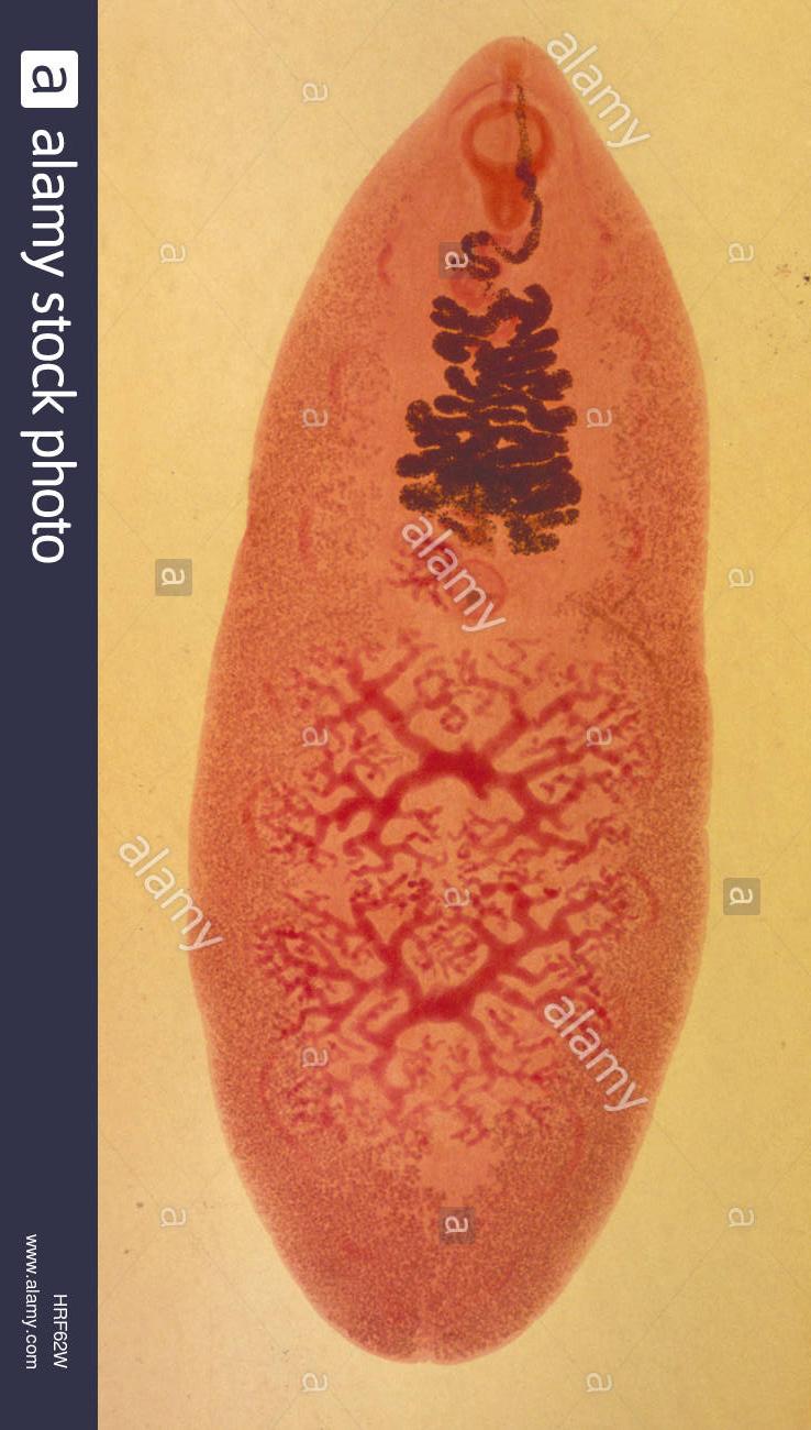 Fasciolopsis Buski Morphology