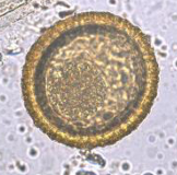 Parascaris Equorum Egg