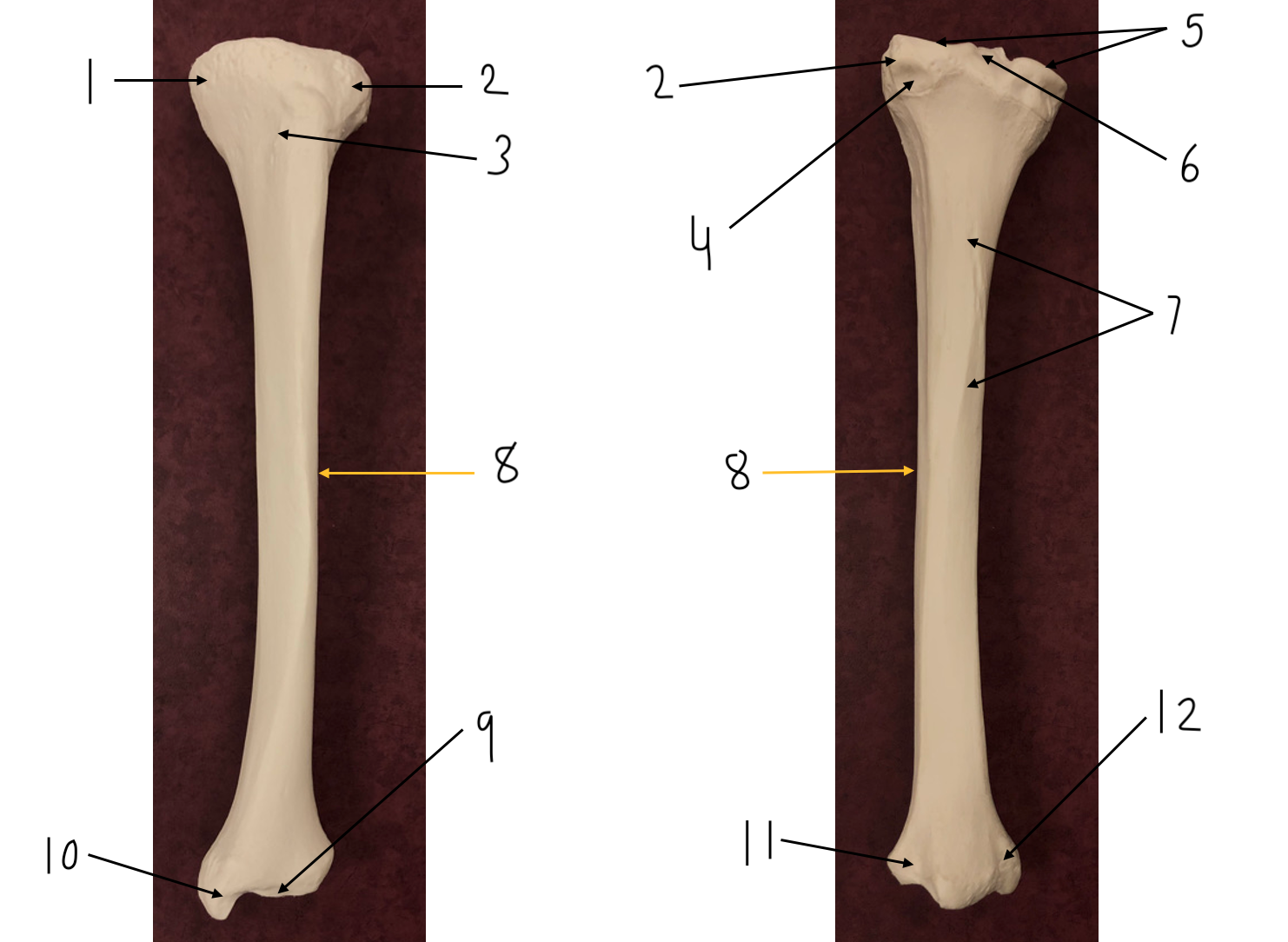 Styloid Process Of Tibia