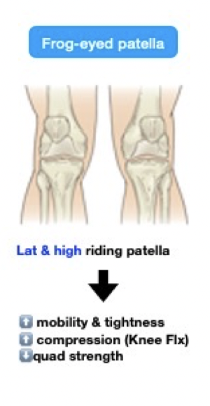 Frog Eyed Patella