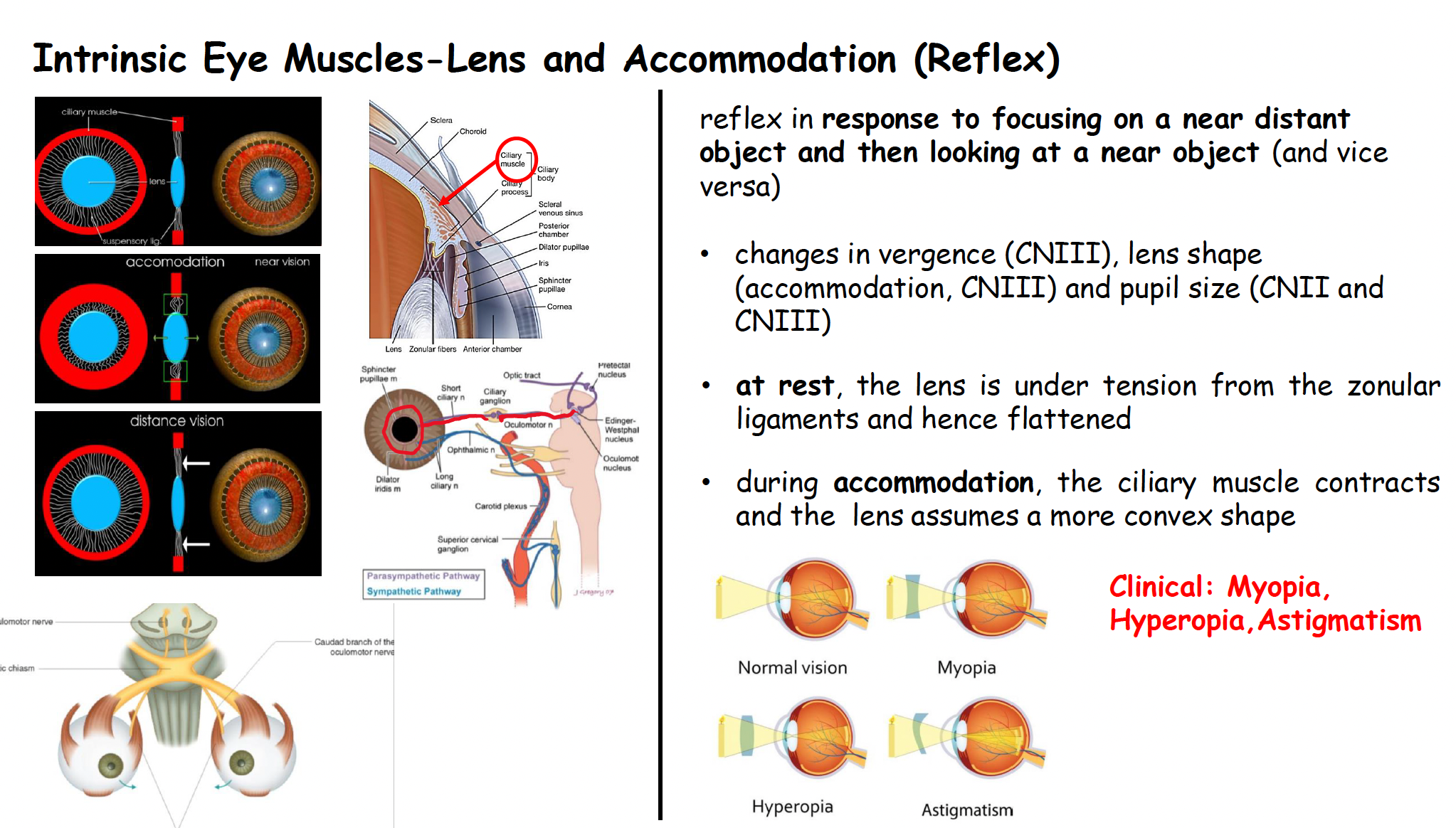 Intrinsic Eye Muscles