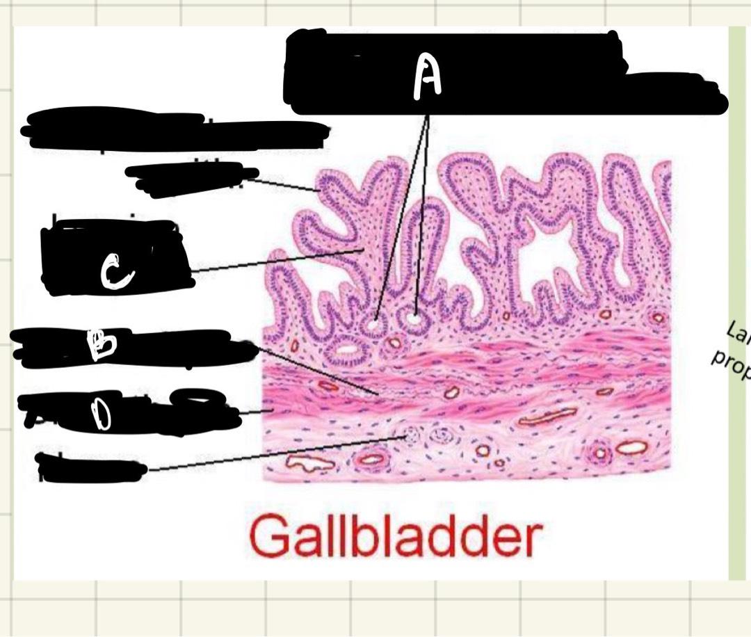 Gallbladder Labeled Histology