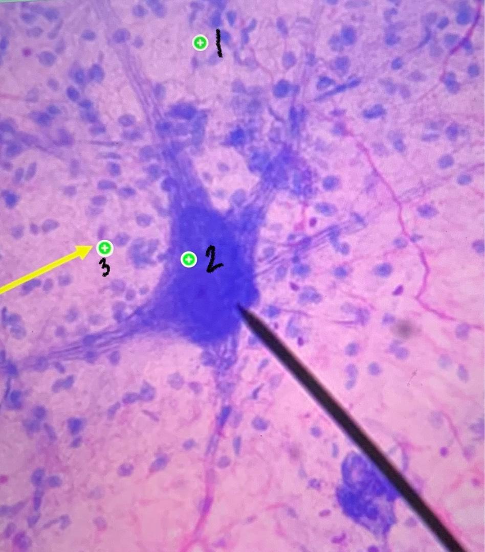Giant Multipolar Neuron Slide