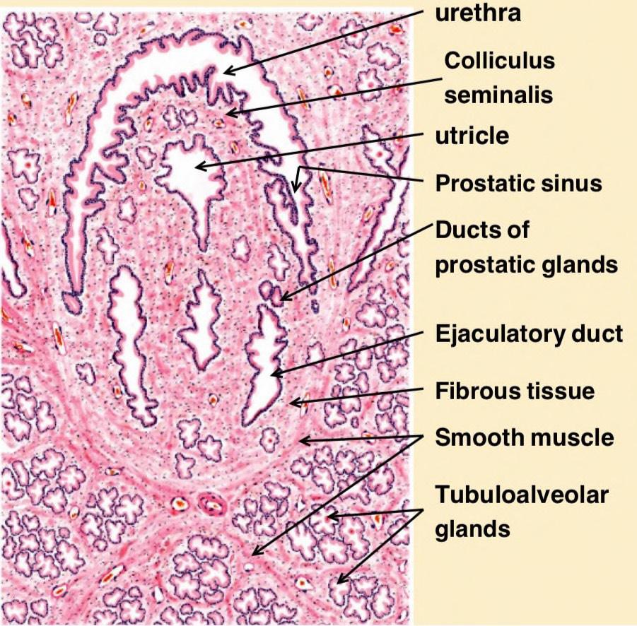 Prostatic Utricle Histology