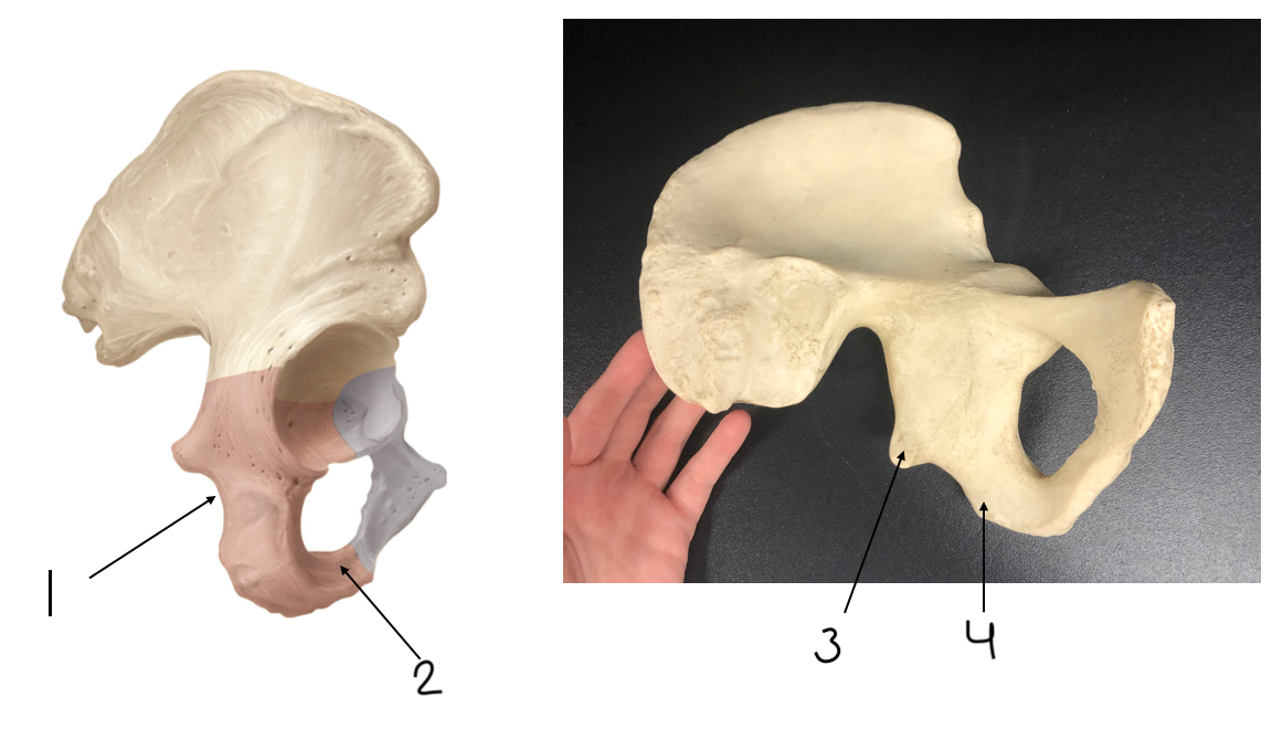 Unlabeled Pelvis