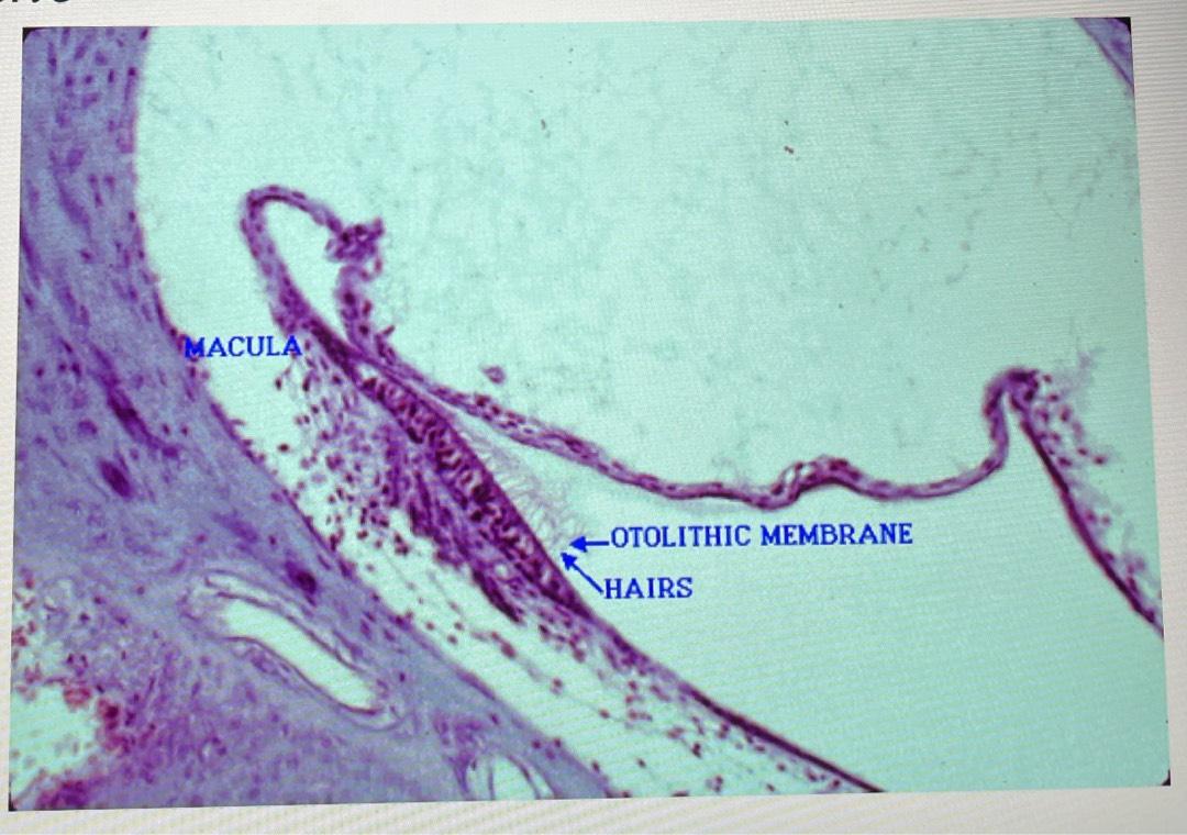 Otolithic Membrane Histology