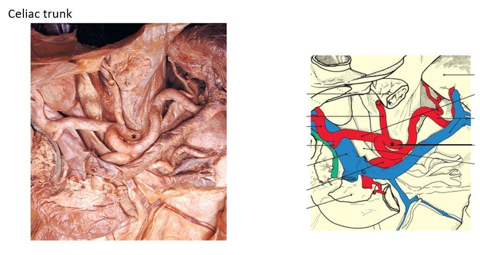 Celiac Trunk Netter