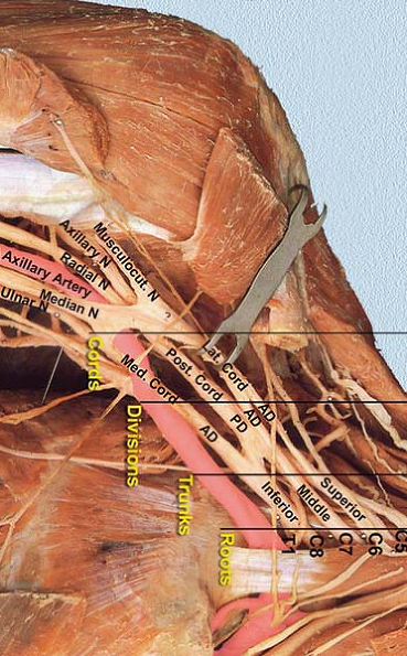 Brachial Plexus Cadaver