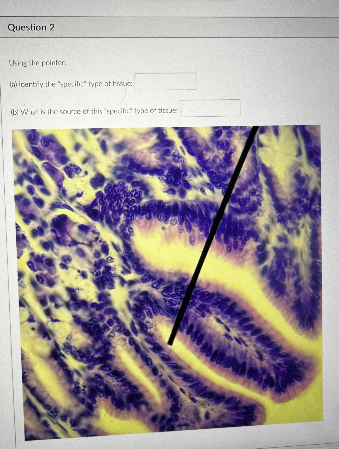 Solved Question 2Using the pointer,(a) ﻿identify the | Chegg.com