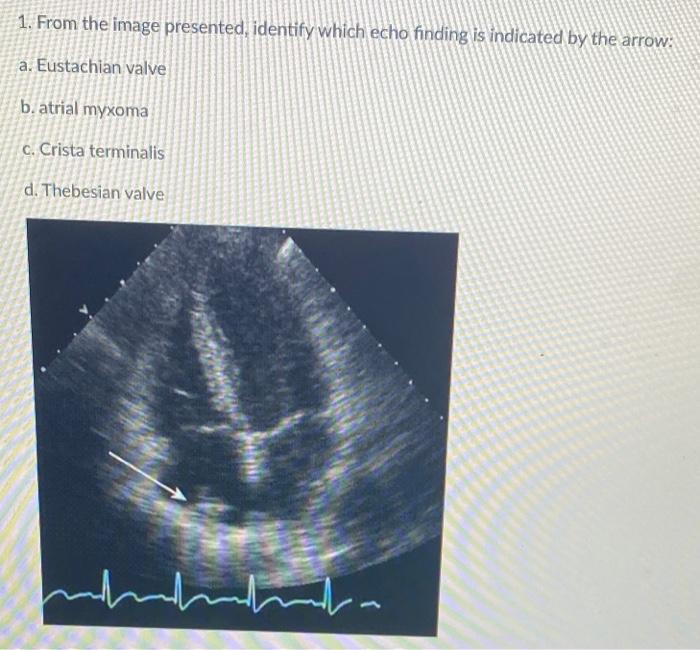 Solved 1. From the image presented, identify which echo | Chegg.com