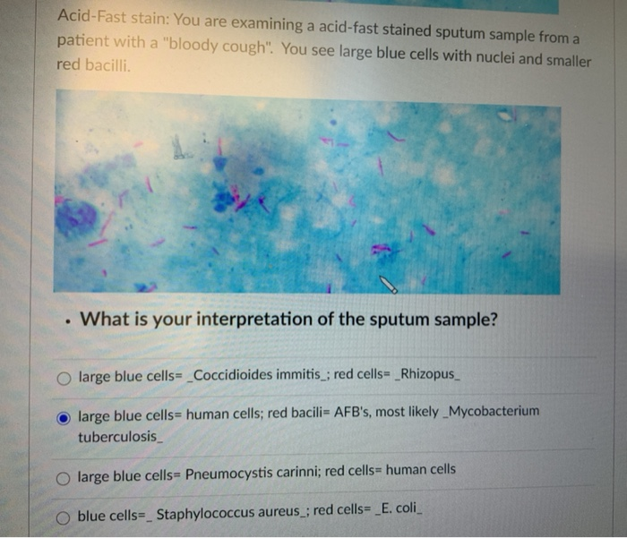 Solved Acid-Fast stain: You are examining a acid-fast | Chegg.com