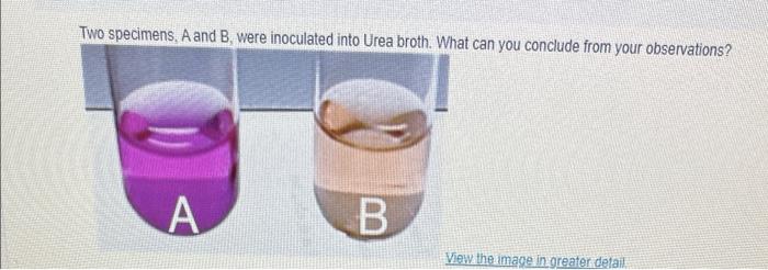 Solved Two specimens, A and B were inoculated into Urea | Chegg.com
