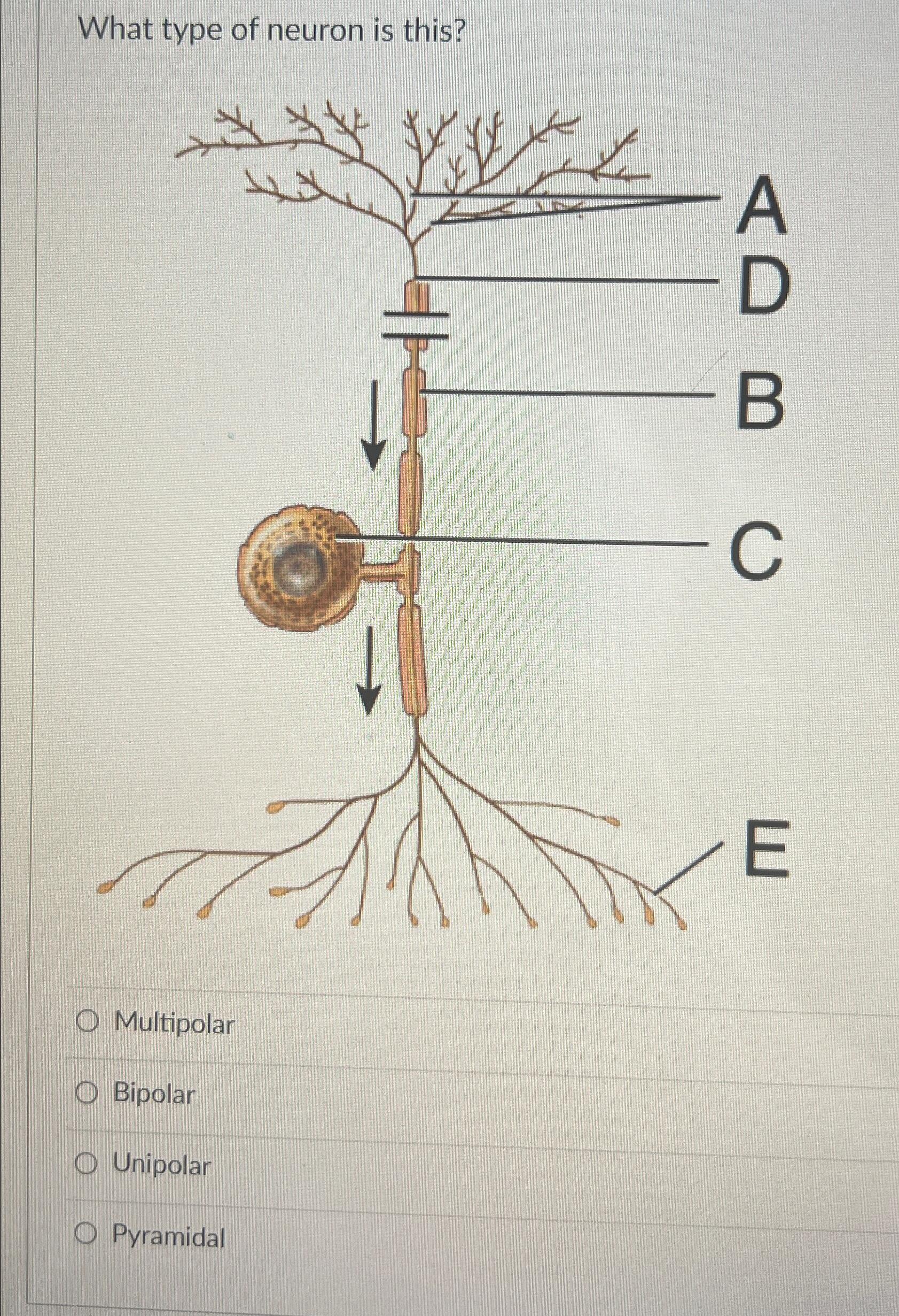 Solved What type of neuron is this | Chegg.com