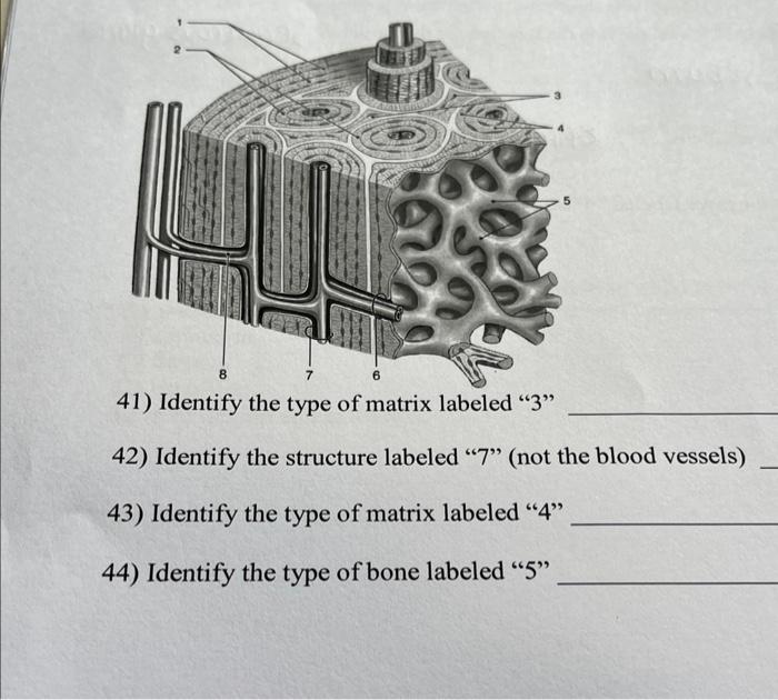 Solved 41) Identify the type of matrix labeled " 3 " 42) | Chegg.com