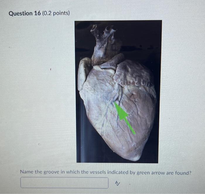 Solved Question 16 (0.2 points) Name the groove in which the | Chegg.com