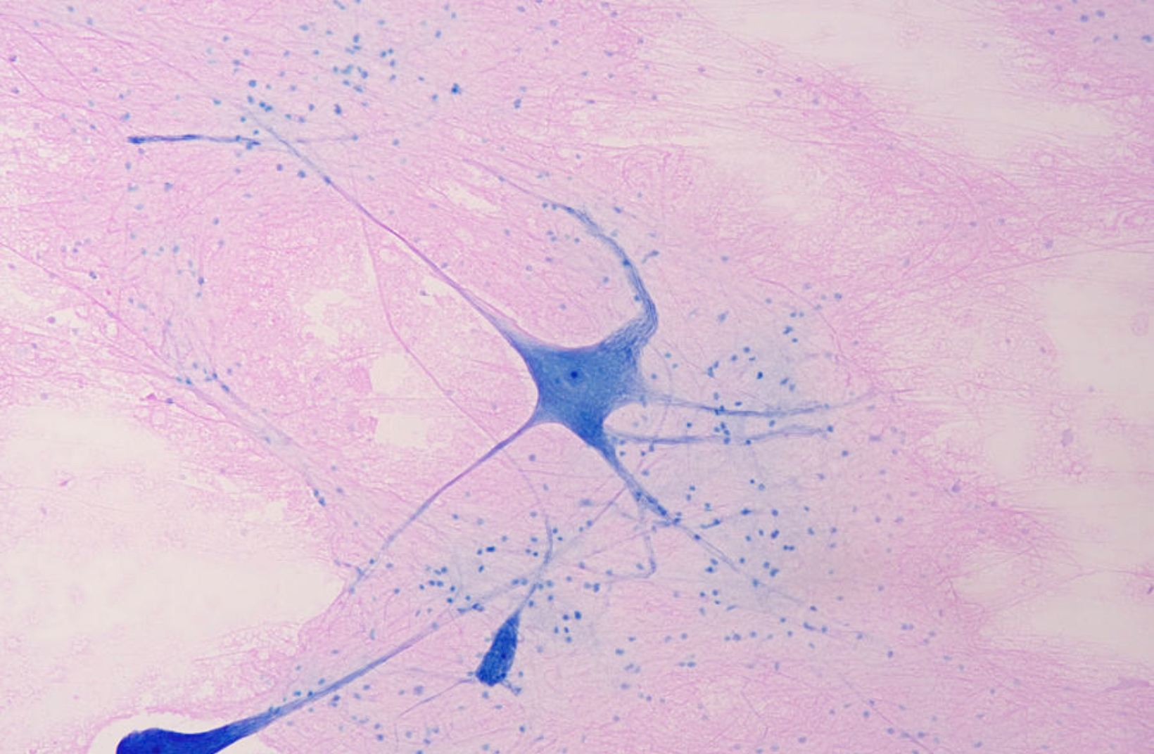 Giant Multipolar neurons (smear prep)label see cell | Chegg.com
