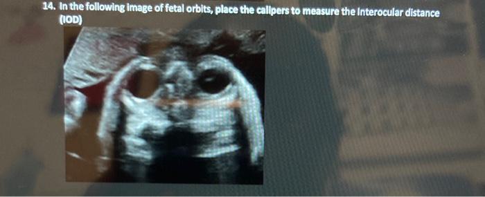 Solved 12. In the following image of fetal orbits, place the | Chegg.com