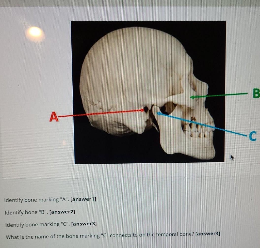 Solved B. A- C Identify bone marking "A". [answer1] Identify | Chegg.com
