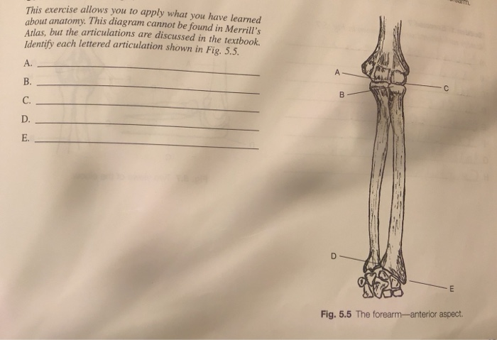 Solved Section 1: Exercise 3 Identify each lettered bone | Chegg.com