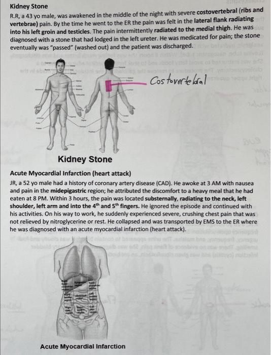 Kidney Stone Pain Chart