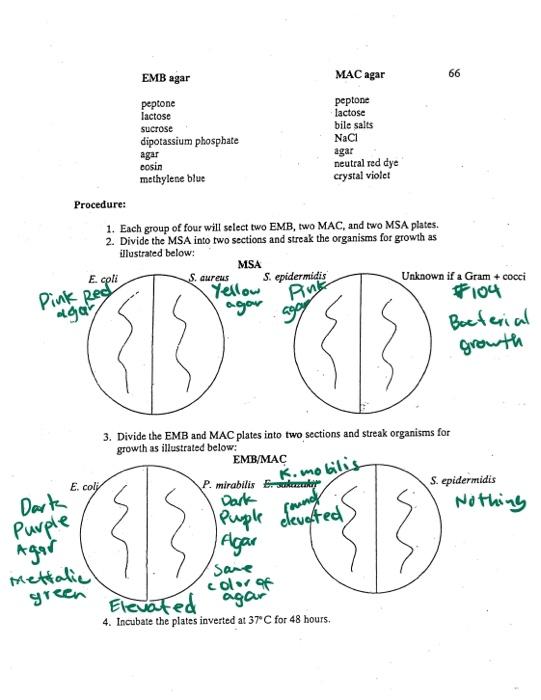 [Solved]: EXERCISE ( $ 25 ) 65 SELECTIVE AND DIFFERENTIA