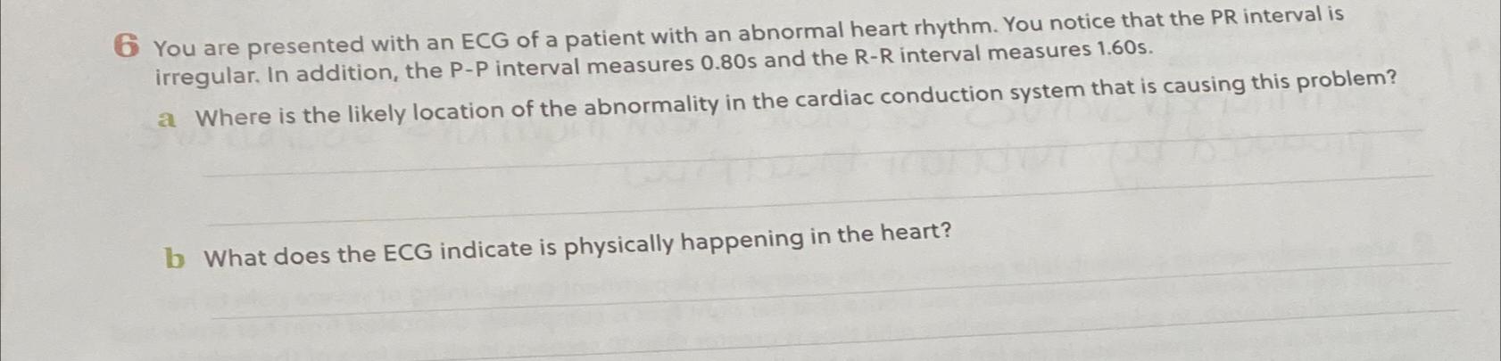 Solved 6 ﻿You are presented with an ECG of a patient with an | Chegg.com