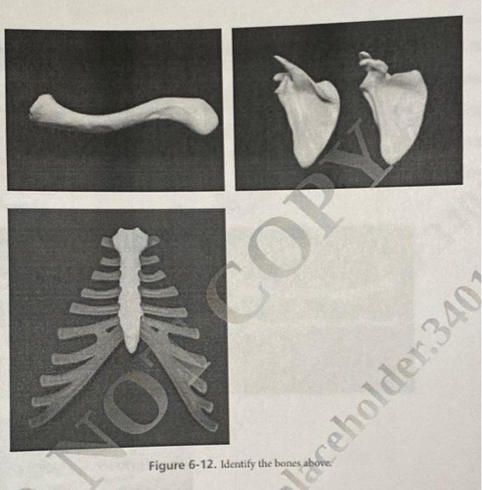 Solved ( JOOP) Figure 6-11B. Label the of the thoracic cage | Chegg.com